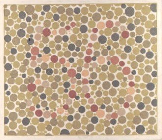 Pseudo-Isochromatic Plate #7