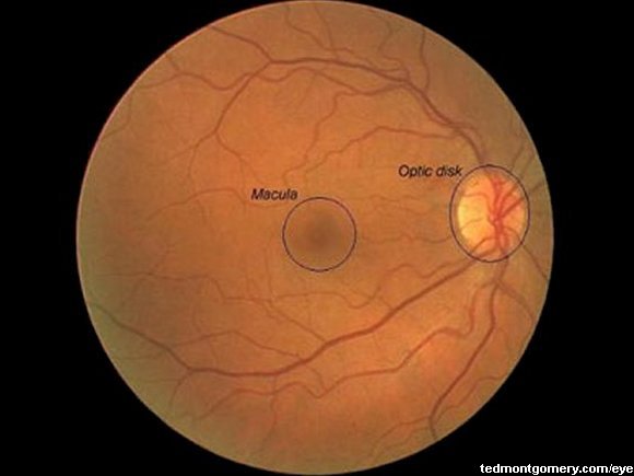 Normal Fundus: #1
